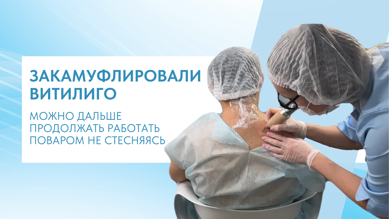 ВИТИЛИГО НА РАЗНЫХ УЧАСТКАХ ТЕЛА, КАК СКРЫТЬ?