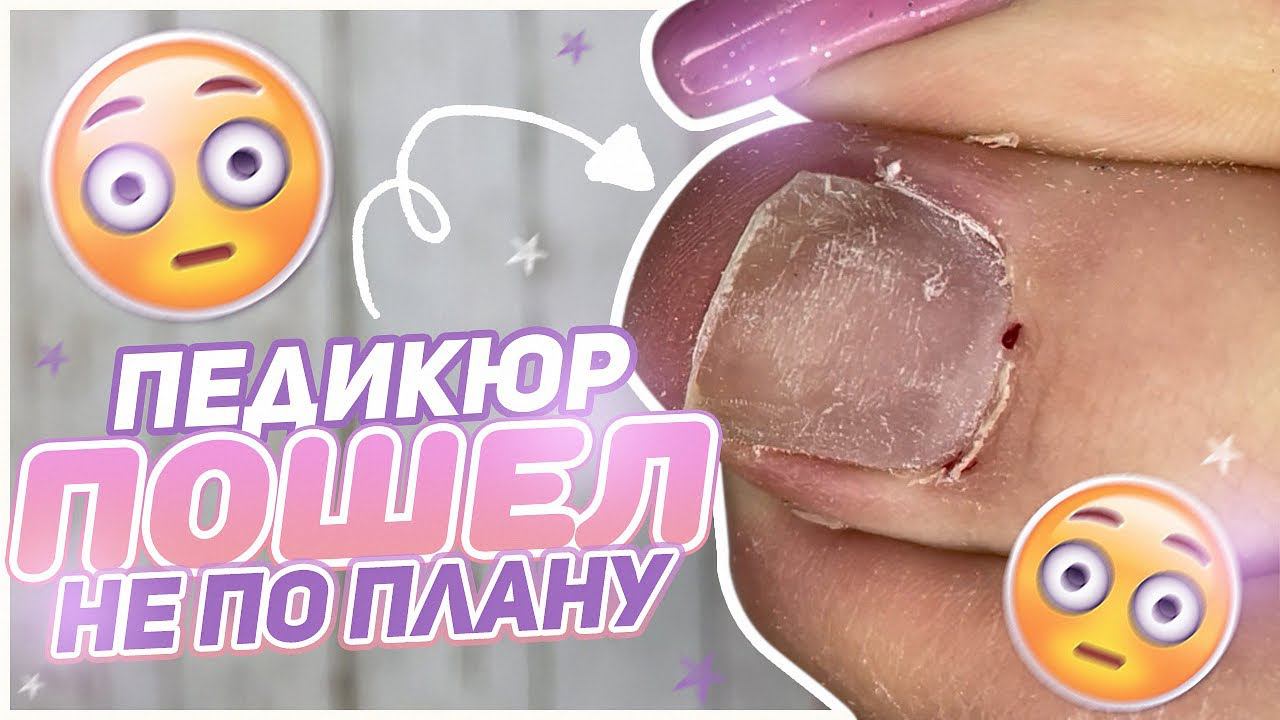 Худший ПЕДИКЮР в моей жизни / педикюр самой себе дома
