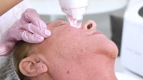 Процедура LaseMD Lutronic, Клиника  La7