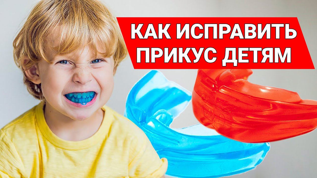 Исправление прикуса у детей с помощью трейнера