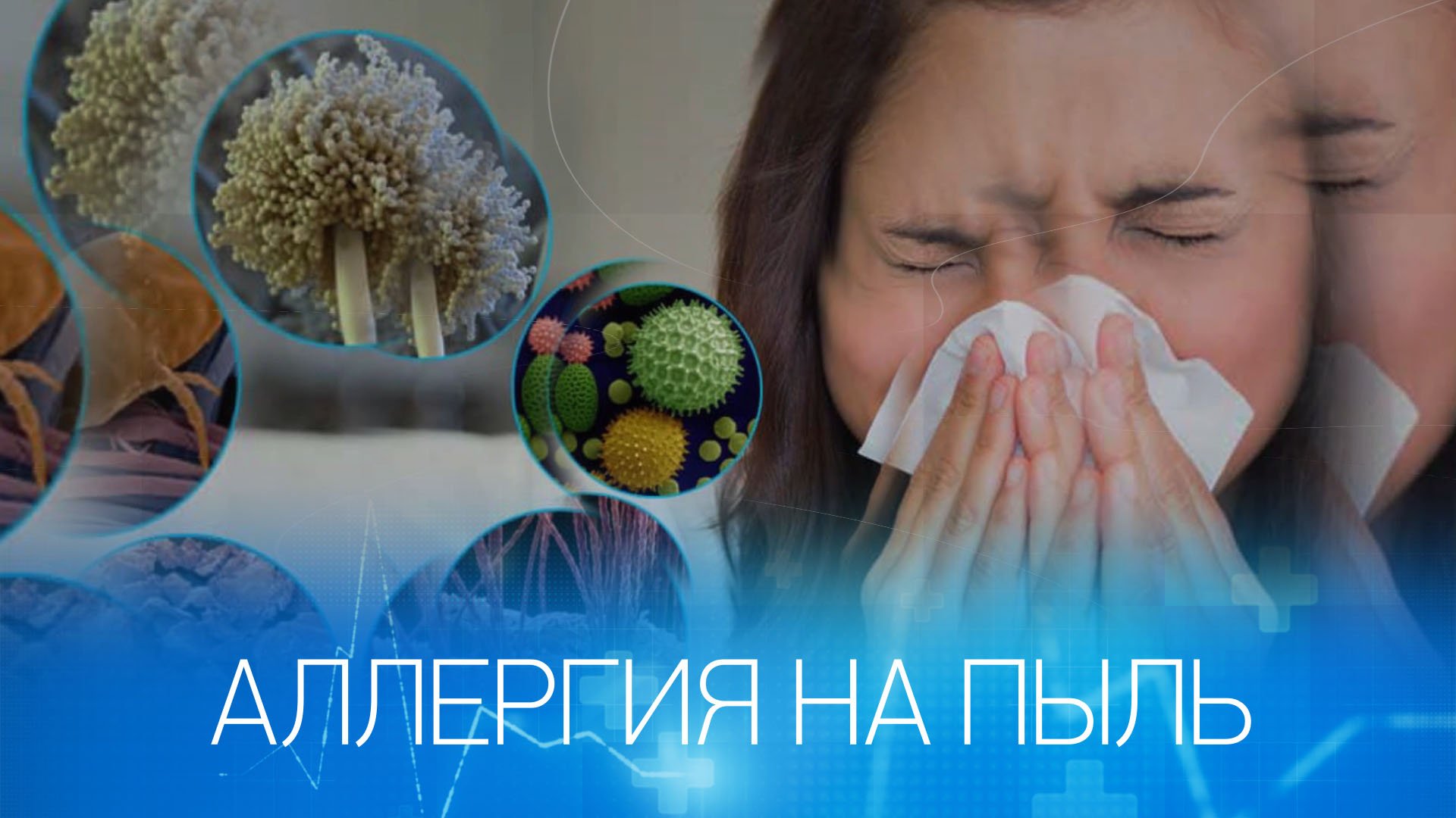 Аллергия на пыль