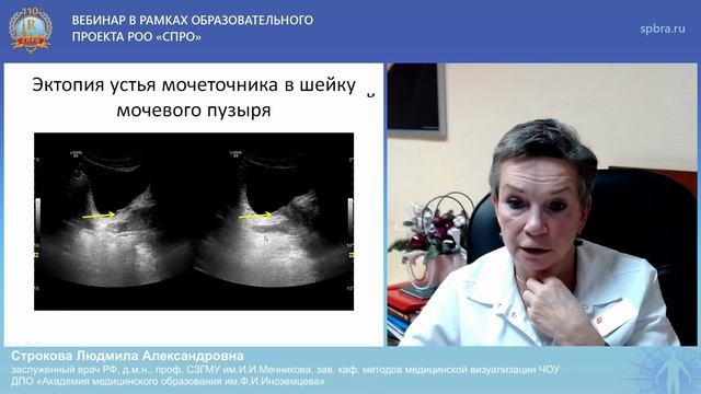 Вебинар "Возможности ультразвуковой диагностики в обследовании мужского малого таза"