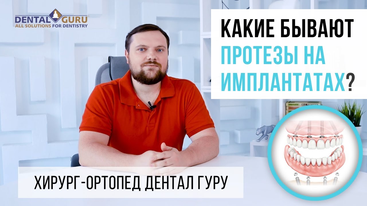 Какие бывают протезы на имплантатах?