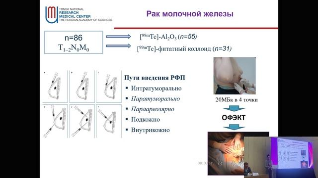 Медведева А.А. Радионуклидная визуализация сторожевых ЛУ при злокачественных новообразованиях