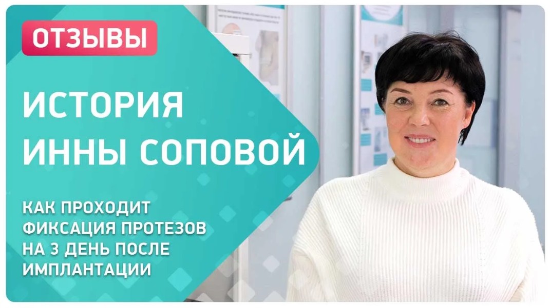 Как выглядят протезы, которые фиксируются на 3 день после имплантации всех зубов_