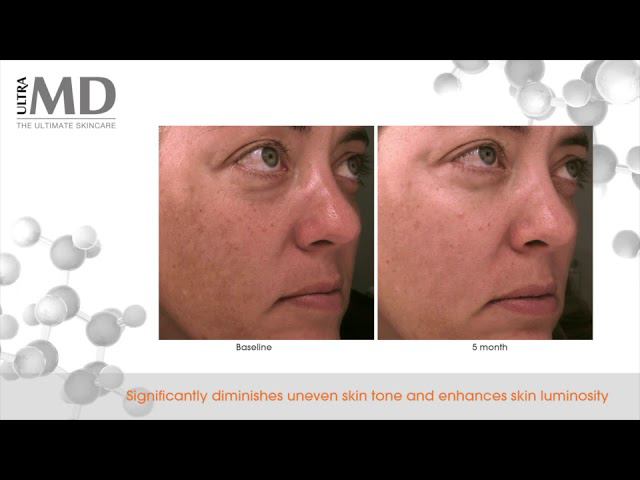 Ultraceuticals MD Cosmetex