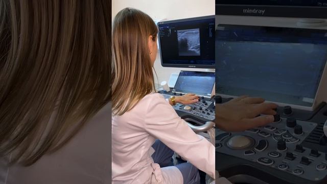 В нашем гастроцентре провожу УЗИ различны органов и систем организма. Стаж 20 лет | #shorts