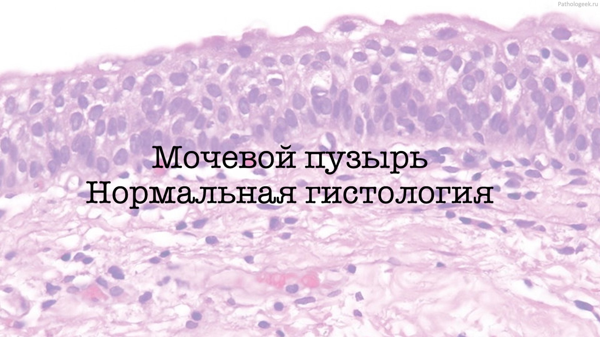 Мочевой пузырь. Нормальная гистология