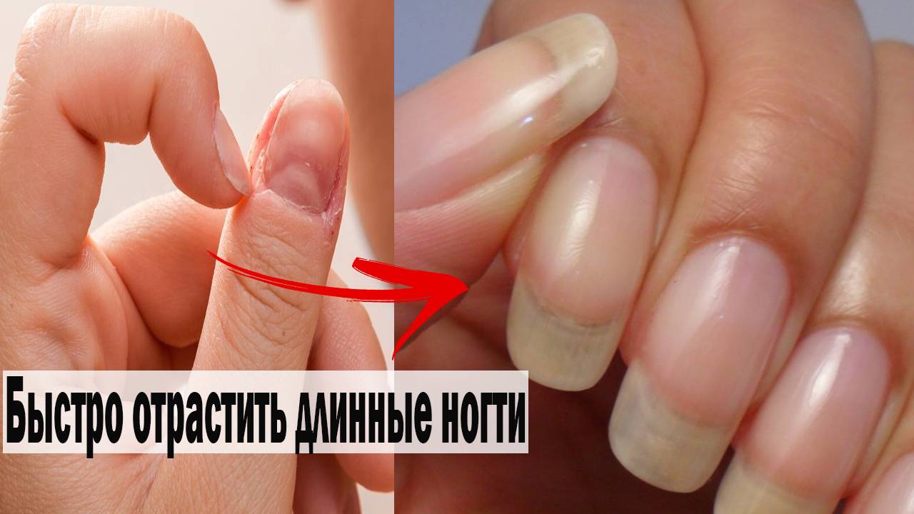 БЫСТРЫЙ рост ногтей обеспечен + как укрепить ногти \ КАК ОТРАСТИТЬ НОГТИ ЗА ПАРУ ДНЕЙ