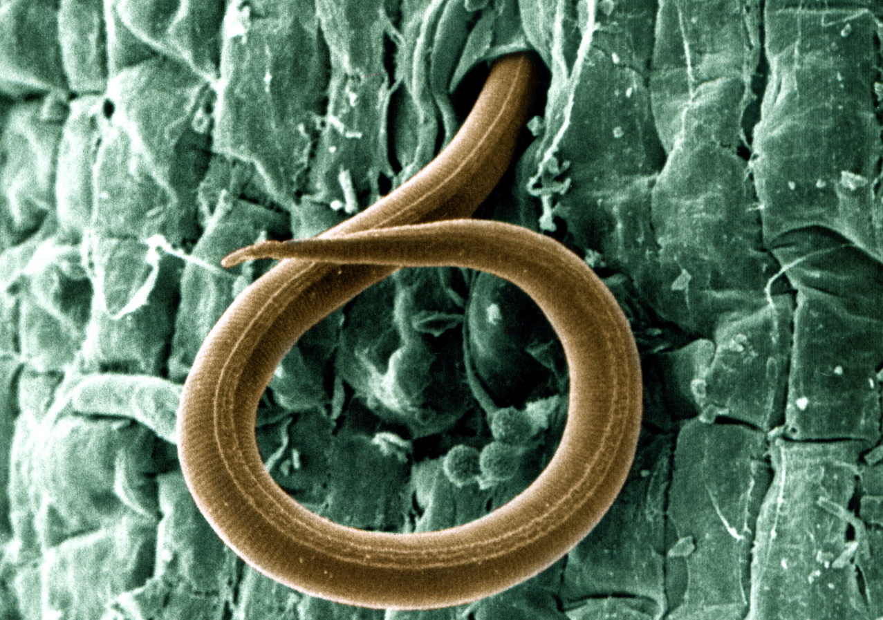 Как избавиться от паразитов Лучшие народные методы