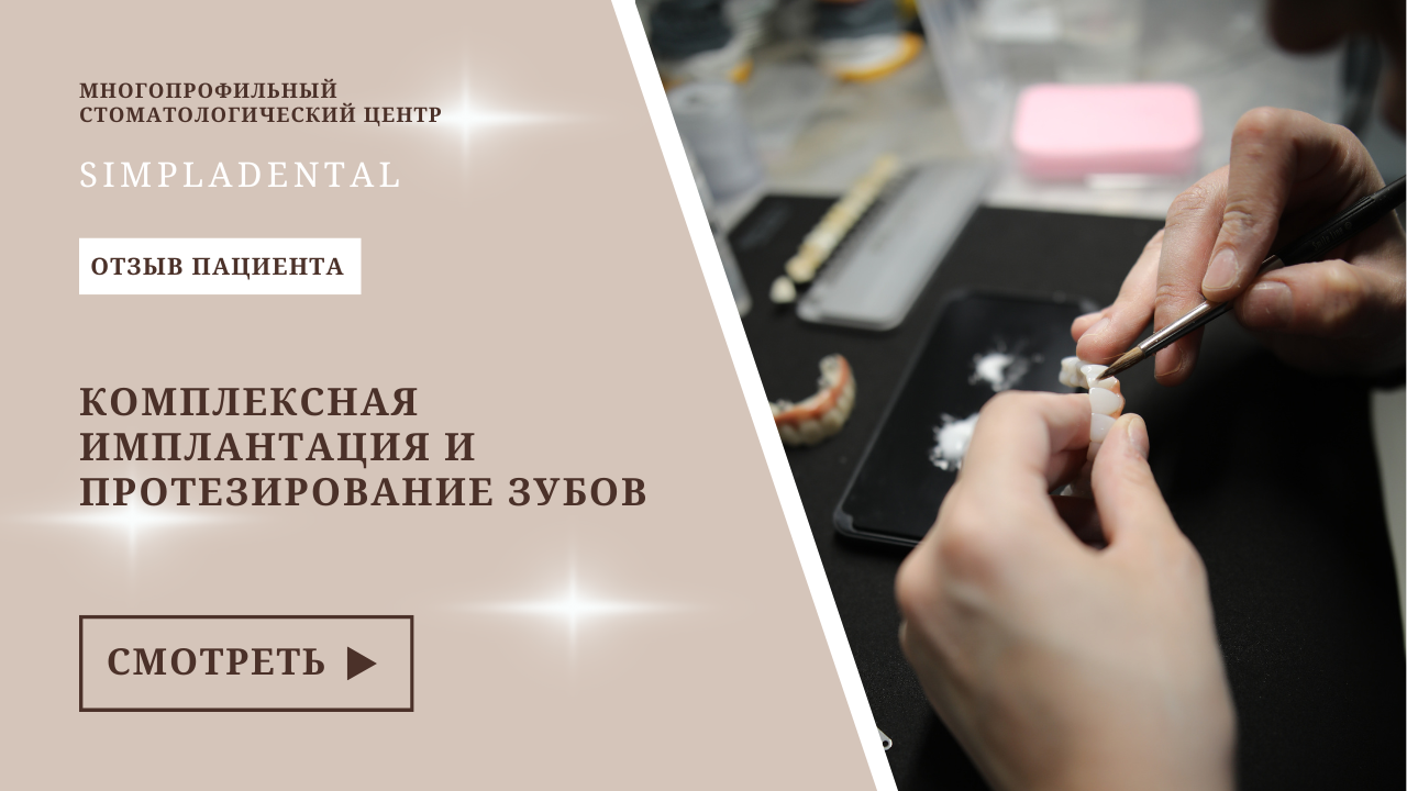 Комплексная имплантация и протезирование зубов. Отзыв пациентки.