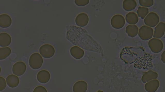 Eosinophil vs Basophil in LBA DBA blood smear - Functions and help for human health by Dianel-Micro