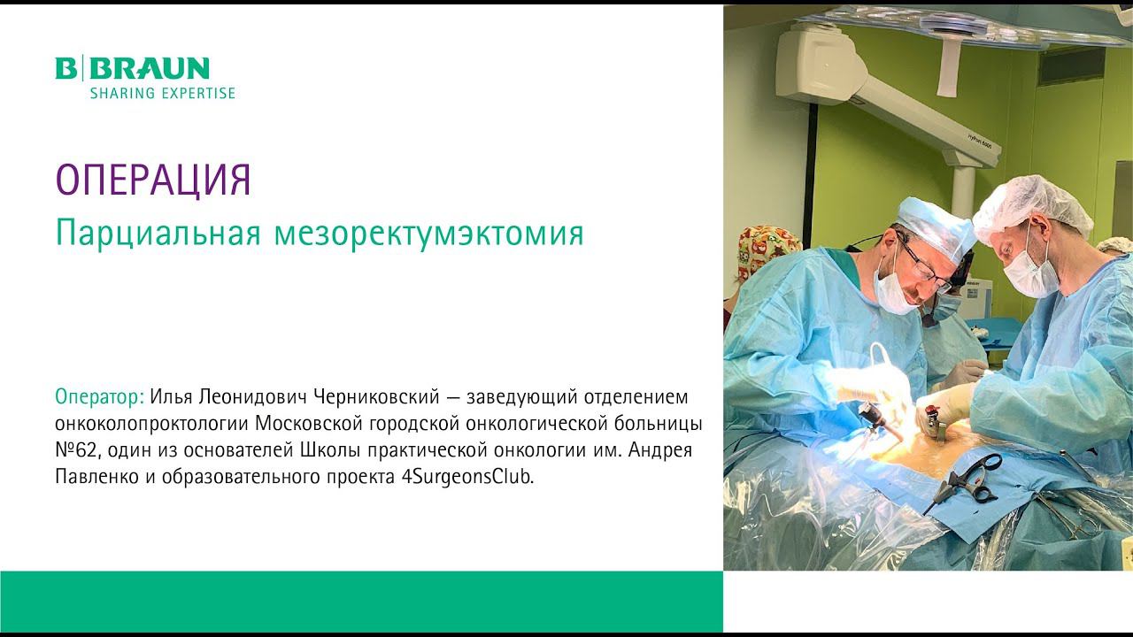 Парциальная мезоректумэктомия | И. Л. Черниковский
