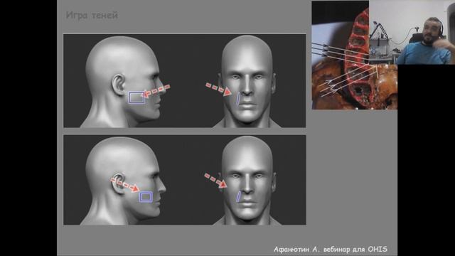 Вебинар №2 - Влияние анатомии на клинические аспекты работы врача.