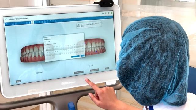 Исправление прикуса без брекетов | Элайнеры