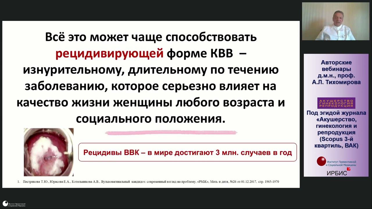 Кандидозный вульвовагинит. Проблемы. Пути решения. Авторский вебинар для врачей.