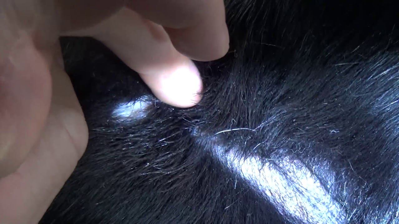 свищи у Лёли