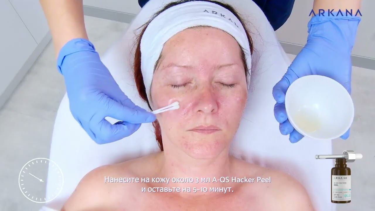 ACNE QS HACKER THERAPY   ИННОВАЦИОННАЯ ТЕРАПИЯ УСТРАНЕНИЯ ПРИЧИН АКНЕ