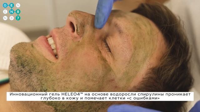 ФОТОДИНАМИЧЕСКАЯ ТЕРАПИЯ HELEO4™ Сеть клиник инновационной косметологии GEN87