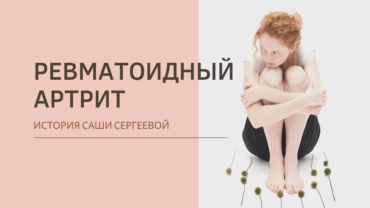 Ревматоидный артрит: история модельного агента Саши Сергеевой