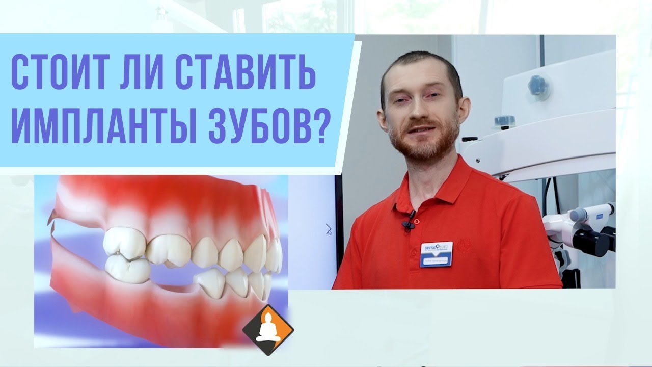 Стоит ли ставить импланты зубов?