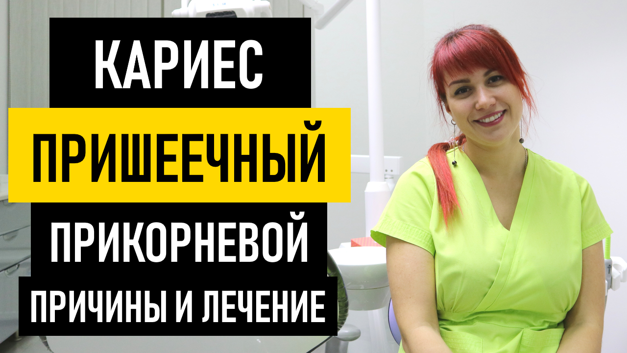 Пришеечный кариес: причины и симптомы. Лечение пришеечного кариеса в домашних условиях