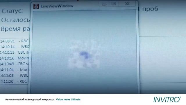 Vision Hema Ultimate в лаборатории INVITRO | West Medica