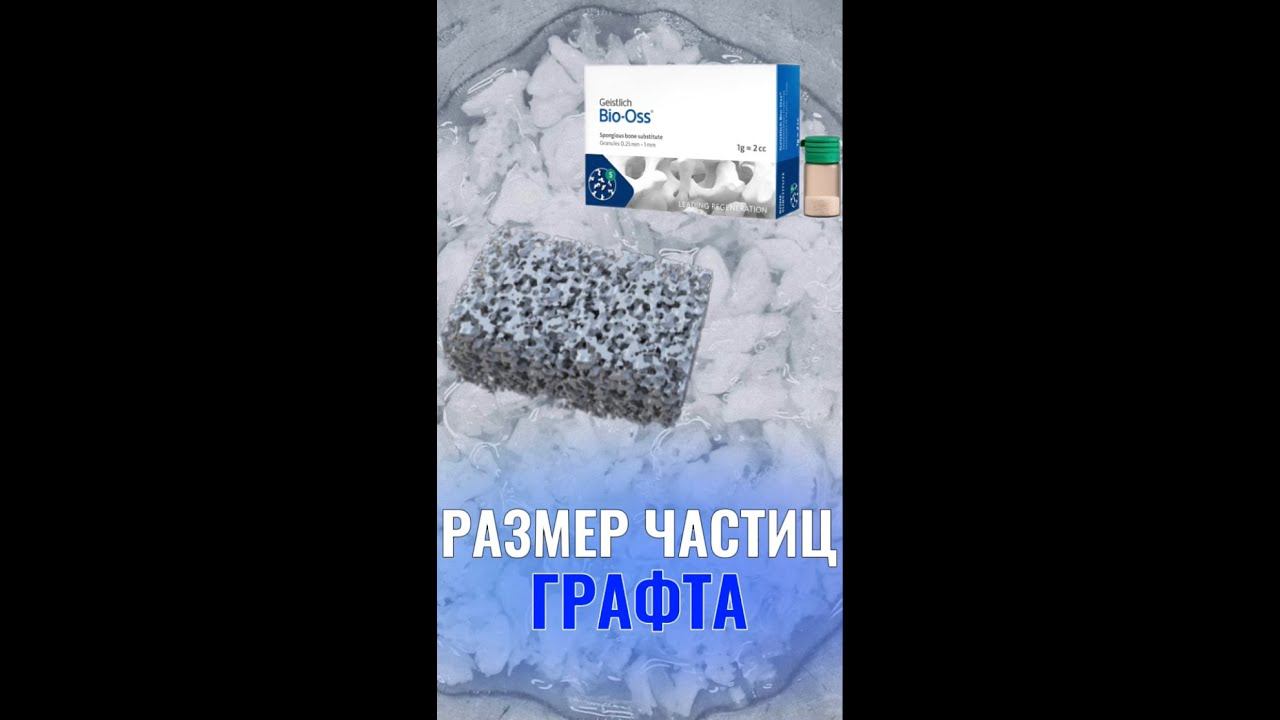 Зависимость качества аугментата после синус-лифтинга от размера частиц графта