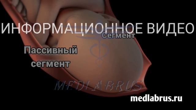 Вагинальные роды-Первая стадия родов: 3D-анимация процесса и симптомы