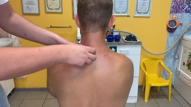 Работа с рубцовыми тканями в районе ШВЗ. Вакуумные банки и Nordblade 3.0. ИММТ/IASTM. Павел Коломиец