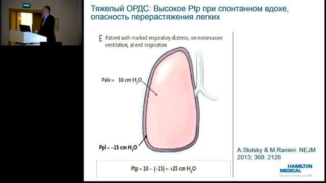 Мониторинг транспульмонарного давления 27.05.17. Сатишур О.Е