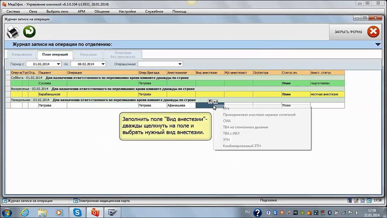 Формирование "Плана операций"
