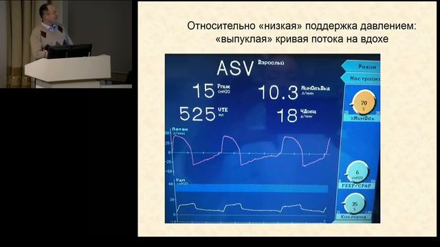 Автоматизрованная синхронизация аппарата ИВЛ САТИШУР О.Е