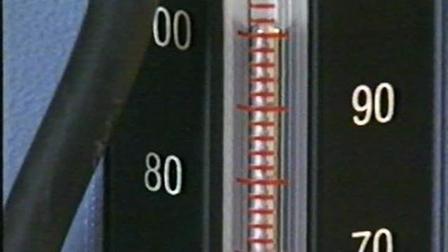 Правила измерения давления