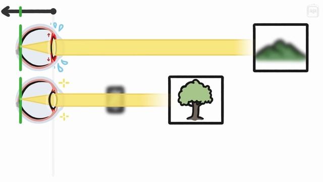 Зрение портят не экраны?