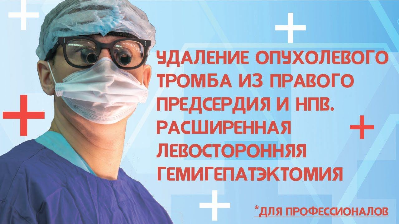 Удаление опухолевого тромба из правого предсердия и НПВ Расширенная левостороння гемигепатэктомия