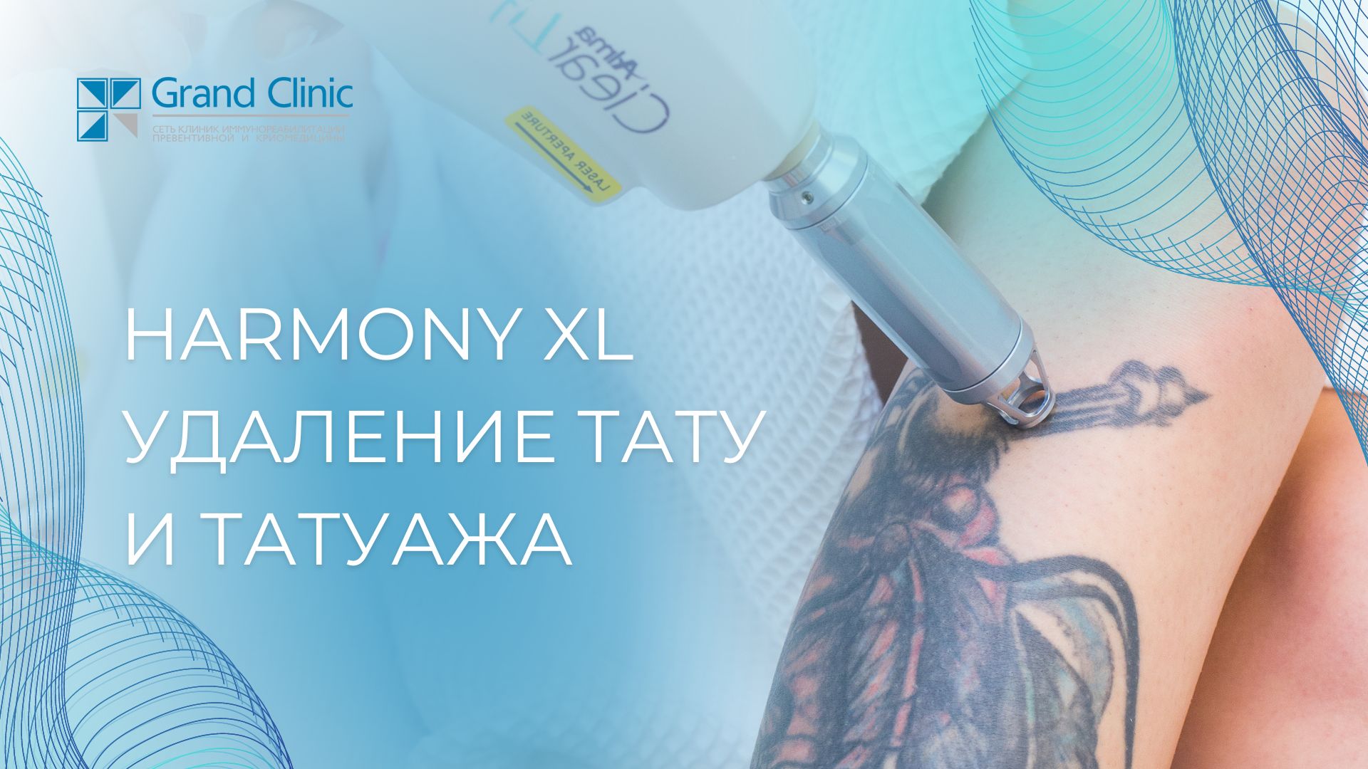 Harmony XL_удаление татуажа
