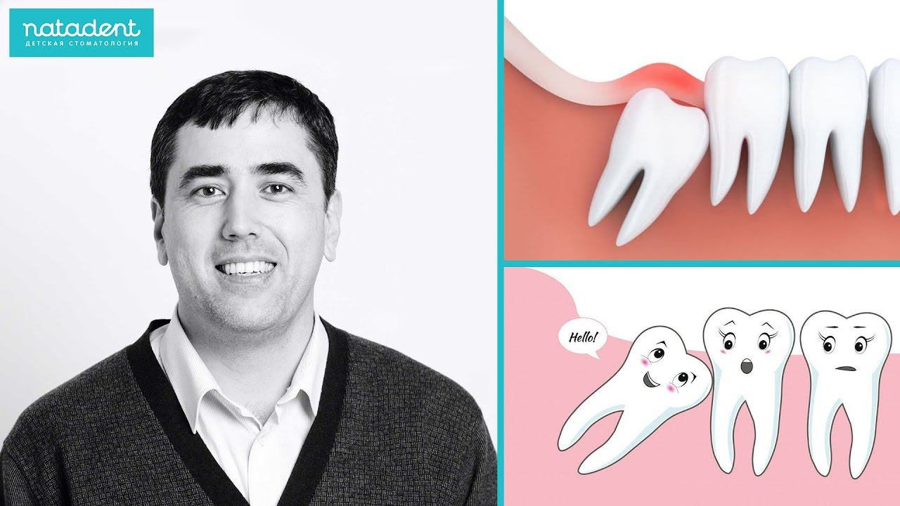 146. Воспаление десен. Капюшон. Натадент Стоматология