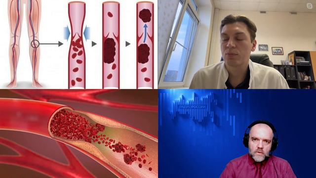 1279. А.Н. Панков: Тромбозы. Лечение или операция