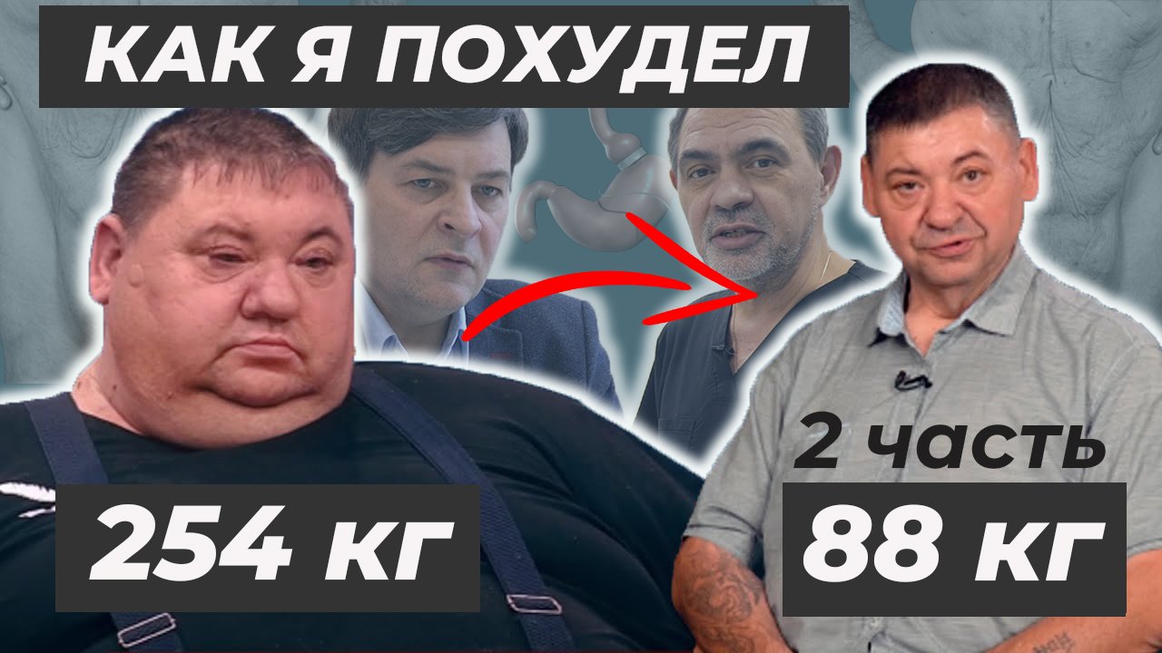 Кардинальное преображение. 2 серия.