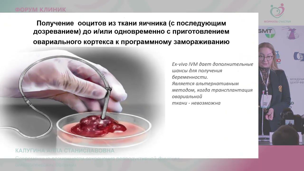 Калугина А.С. «Современные возможности сохранения репродуктивной функции онкологических больных»