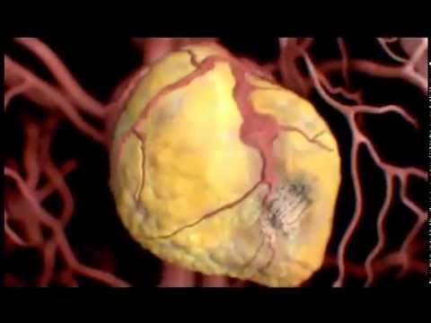 Алкоголь взгляд изнутри ОБЩЕЕ ДЕЛО наркотический ЯД