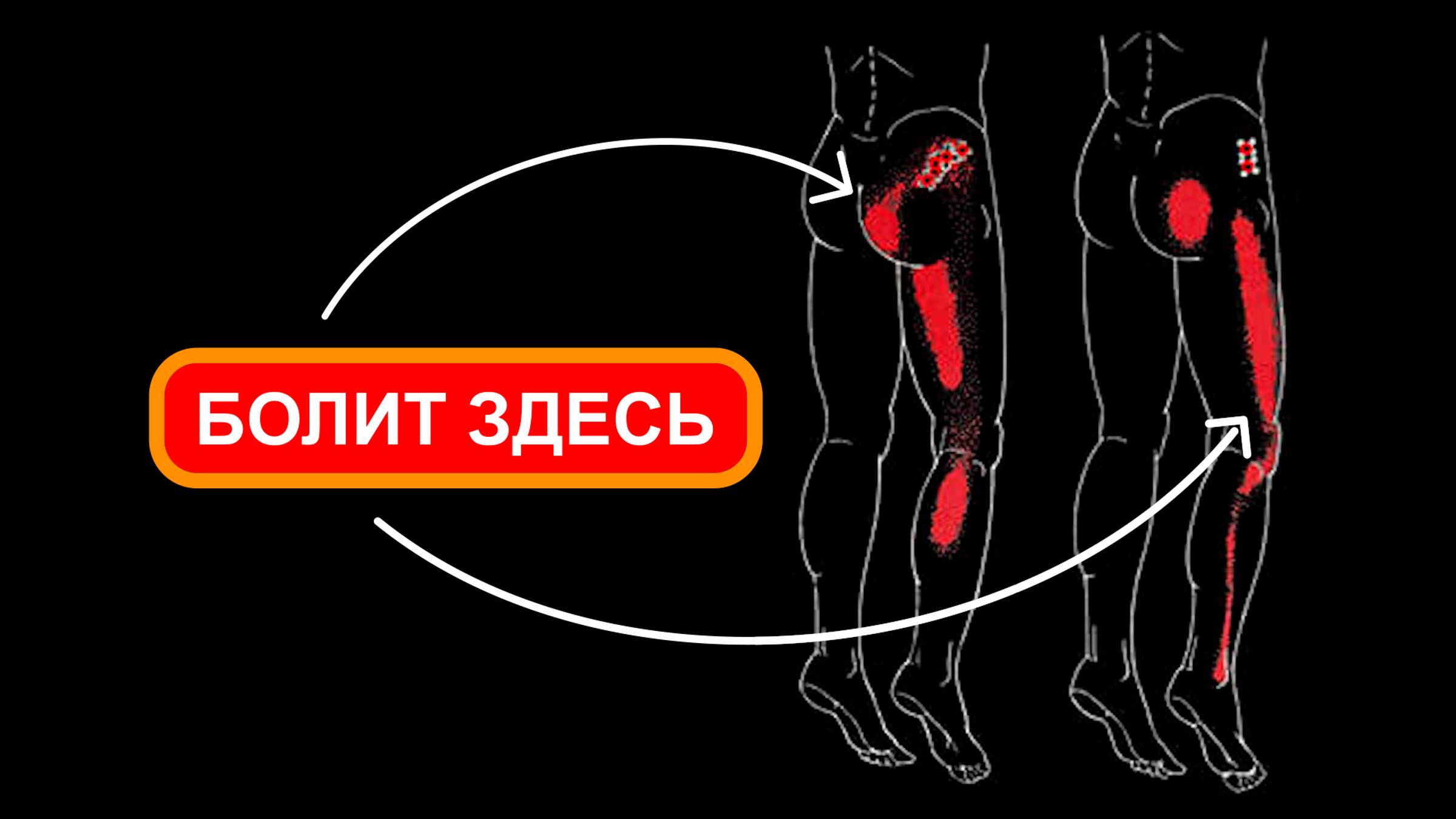 Болит ягодица и отдаёт в ногу