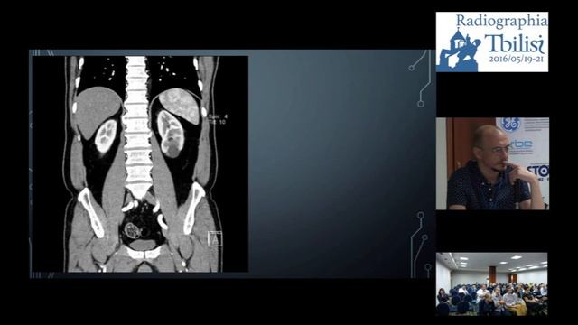 Лучевая диагностика сочетанной патологии. Клинические случаи