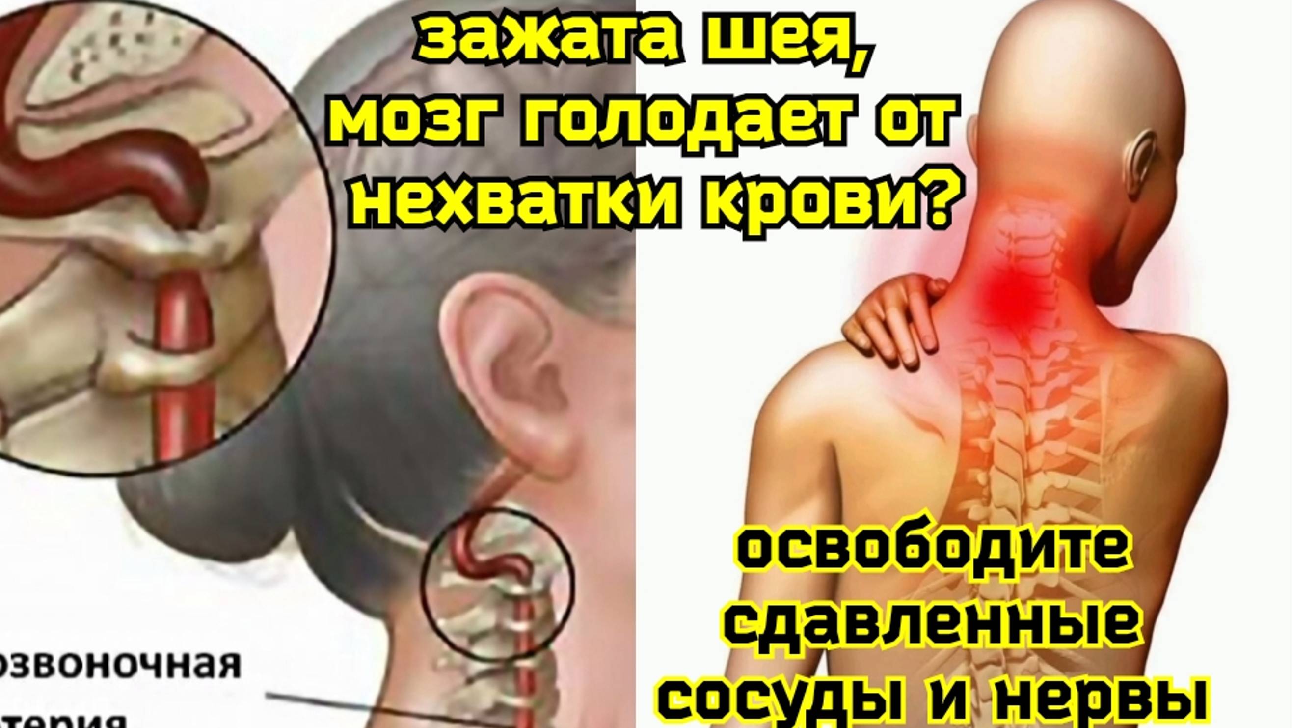 Сосуды шеи дают жизнь сосудам мозга. Как освободить их от сдавливания мышцами и позвонками?