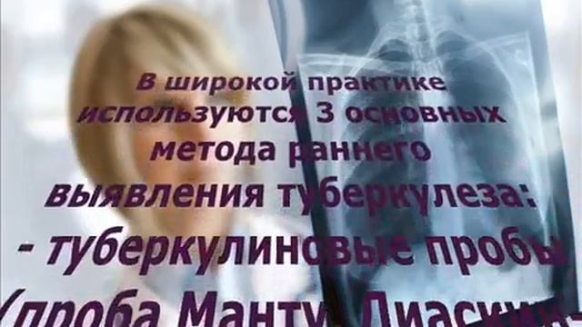 ГДБ №1. Белая ромашка 2017.mp4