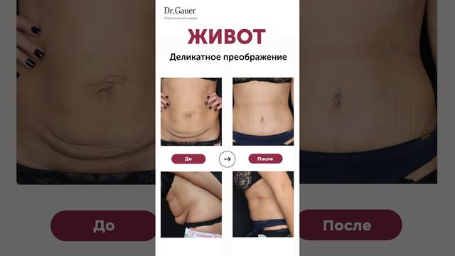 Работы пластического хирурга Л.Н. Гауэр