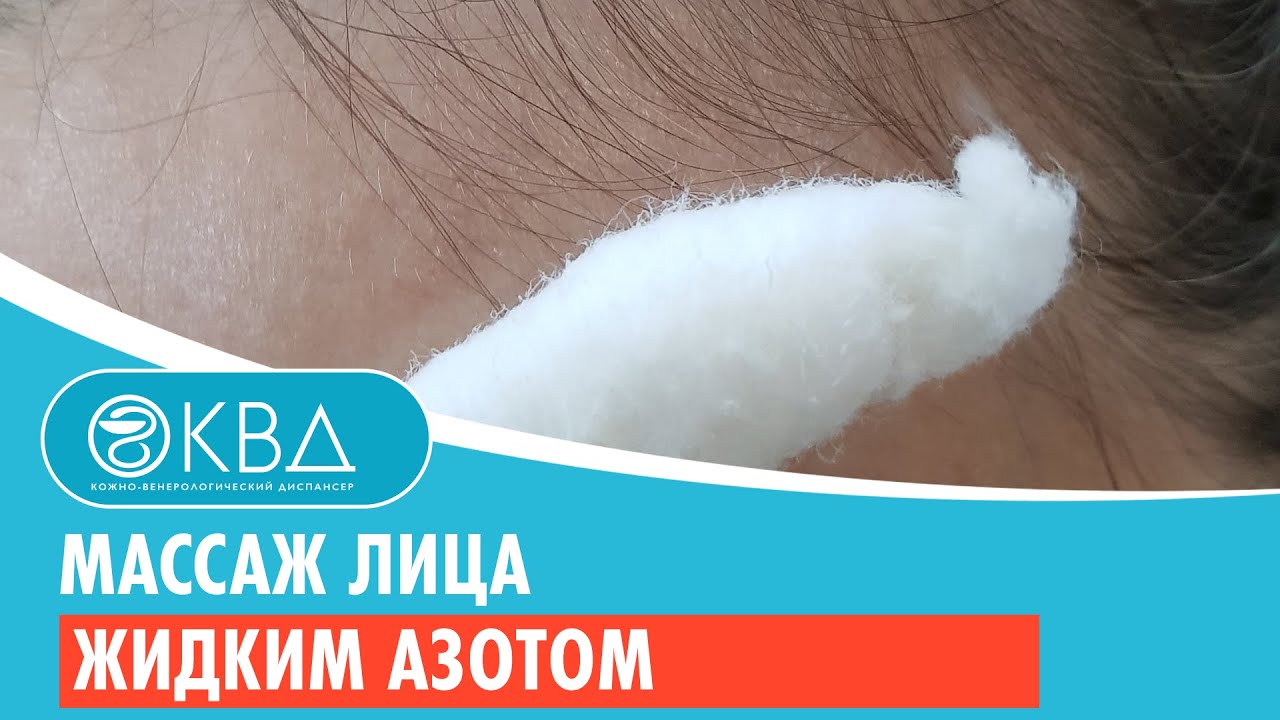 ?♀️ Массаж лица жидким азотом. Клинический случай №261