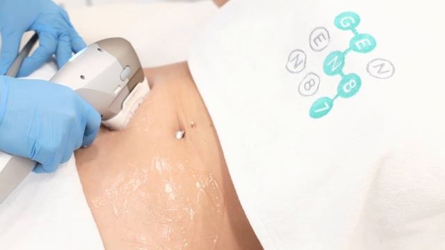 СМАС-ЛИФТИНГ ТЕЛА ULTRAFORMER (УЛЬТРАФОРМЕР) Сеть клиник косметологии GEN87(1)