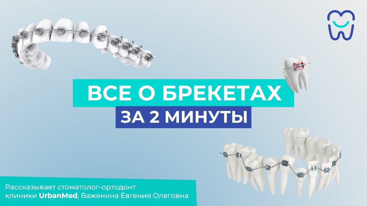 Всё о брекетах за 2 минуты
